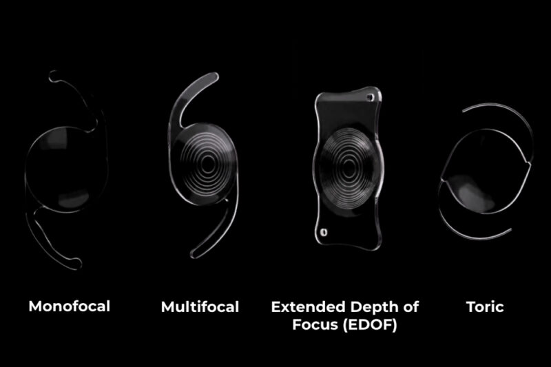 What Are The 4 Types of Cataract Lenses?